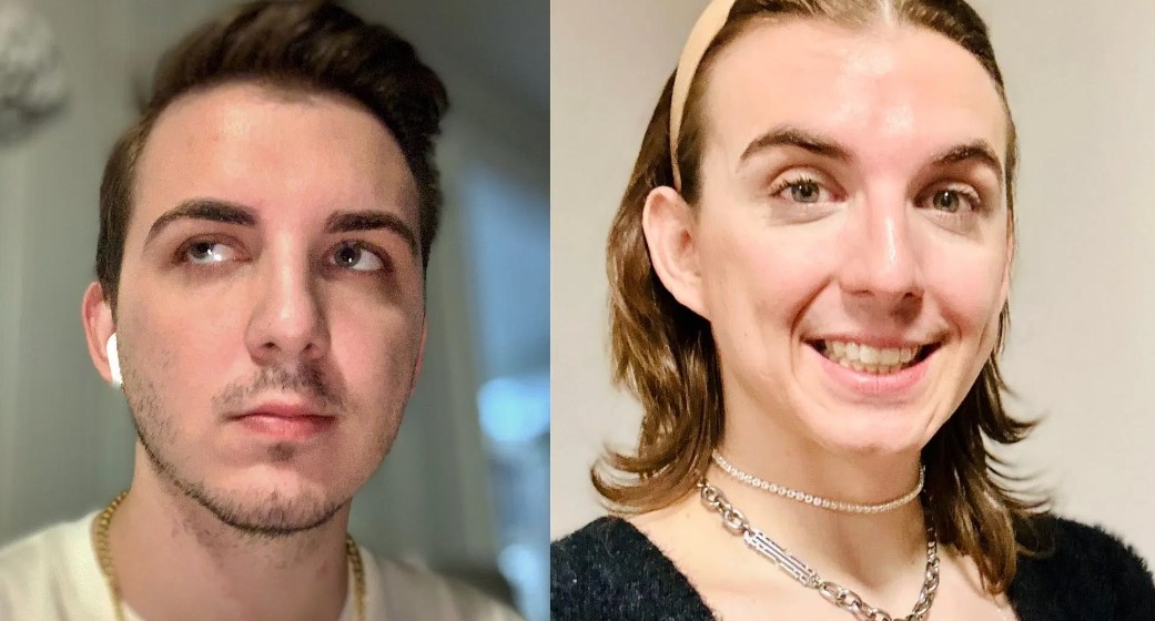 Kris Tyson Before And After, Who is Kris Tyson? Age, Parents and BIO